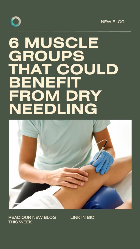 6 Muscle Groups That Could Benefit From Dry Needling After Fall ...